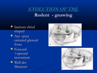 temporomandibular joint-development and anatomy | PPT
