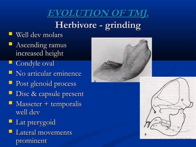 temporomandibular joint-development and anatomy | PPT | Death, Injury ...