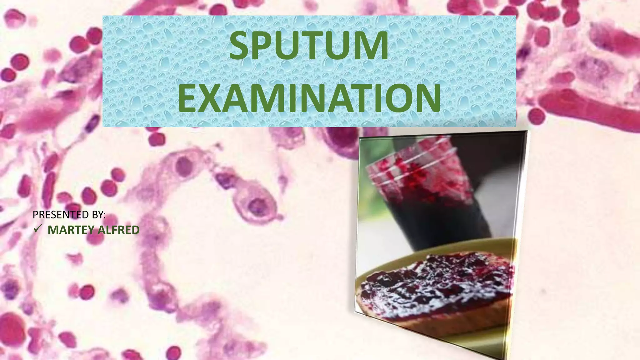 Sputum Examination and Analysis | PPTX