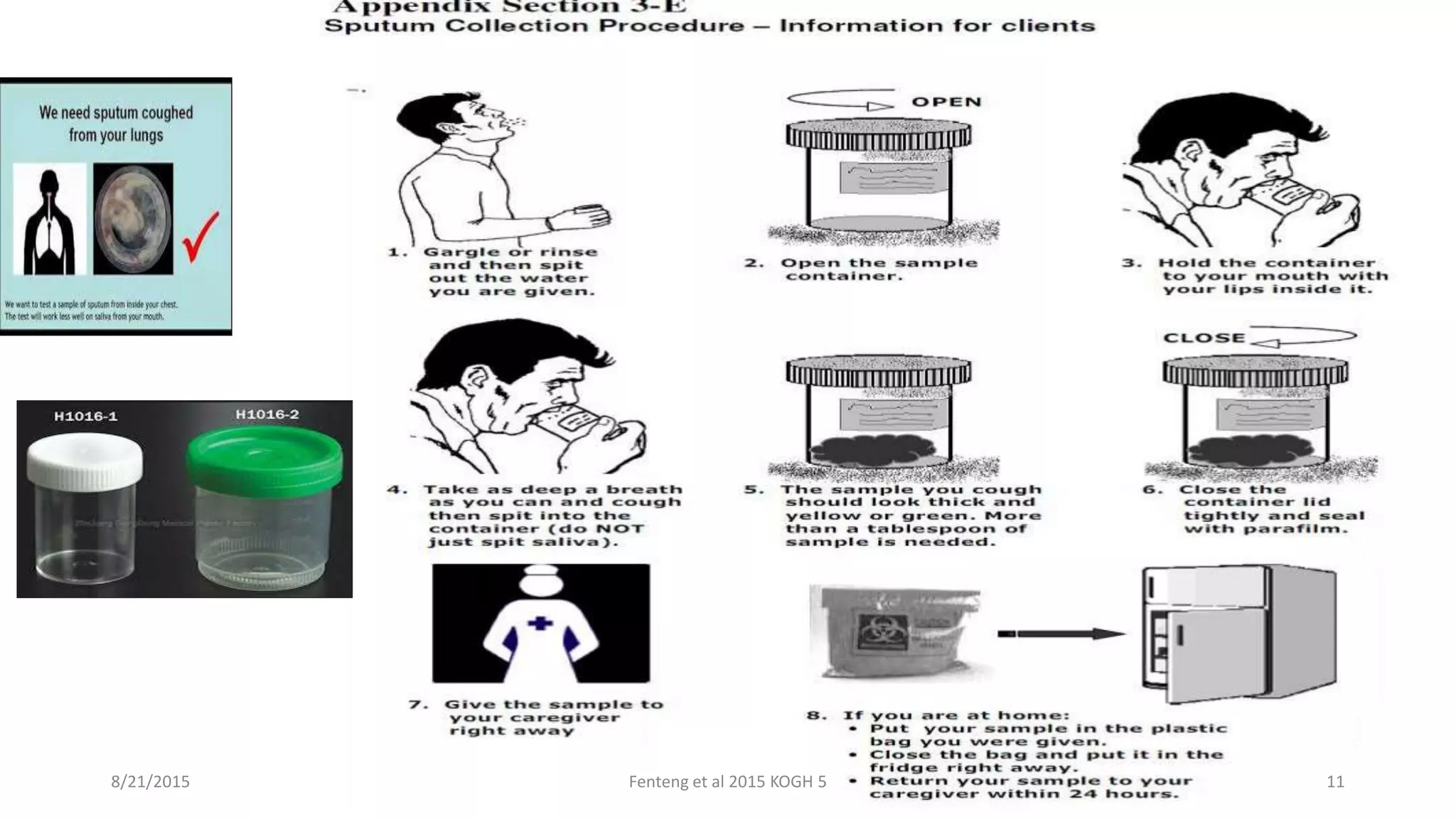 Sputum Examination and Analysis | PPTX