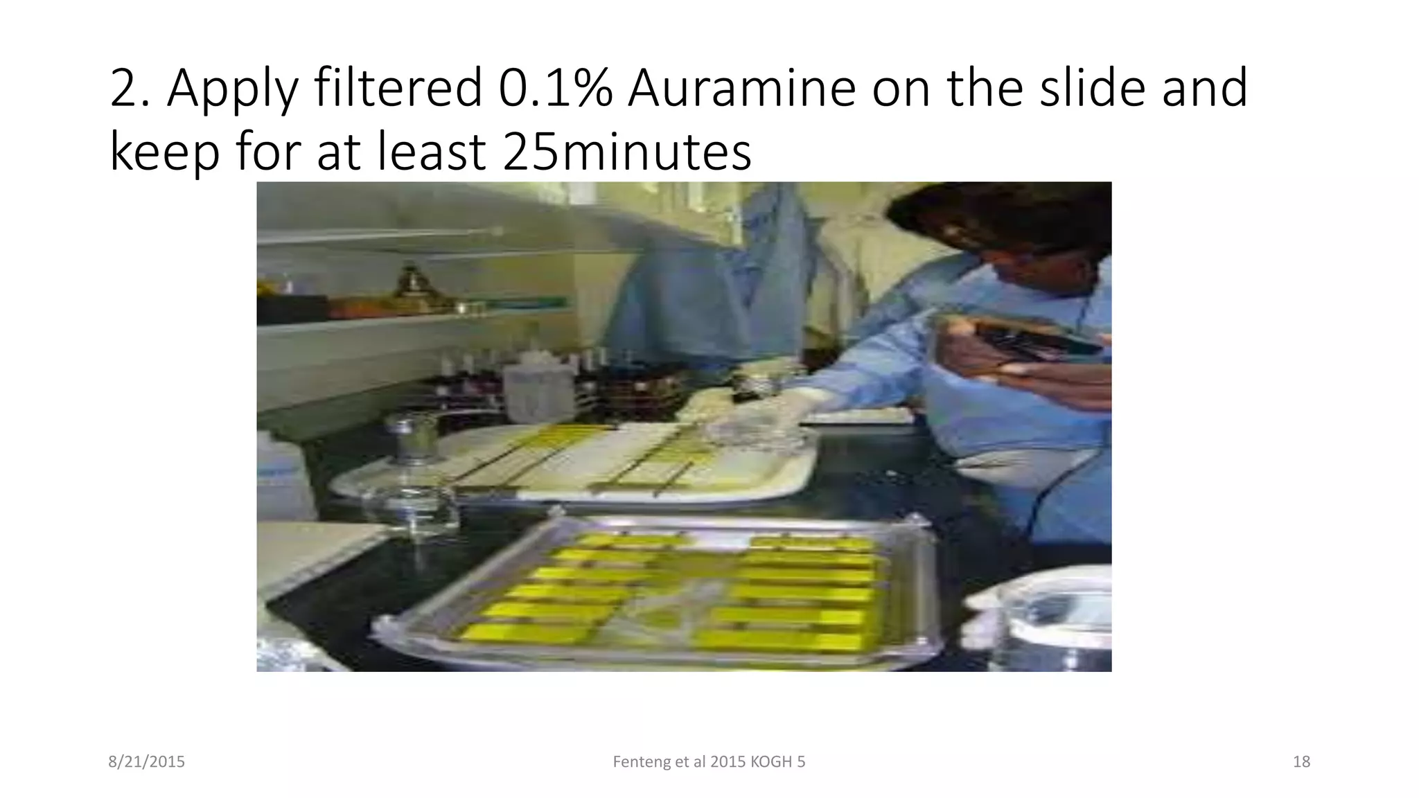 Sputum Examination and Analysis | PPTX