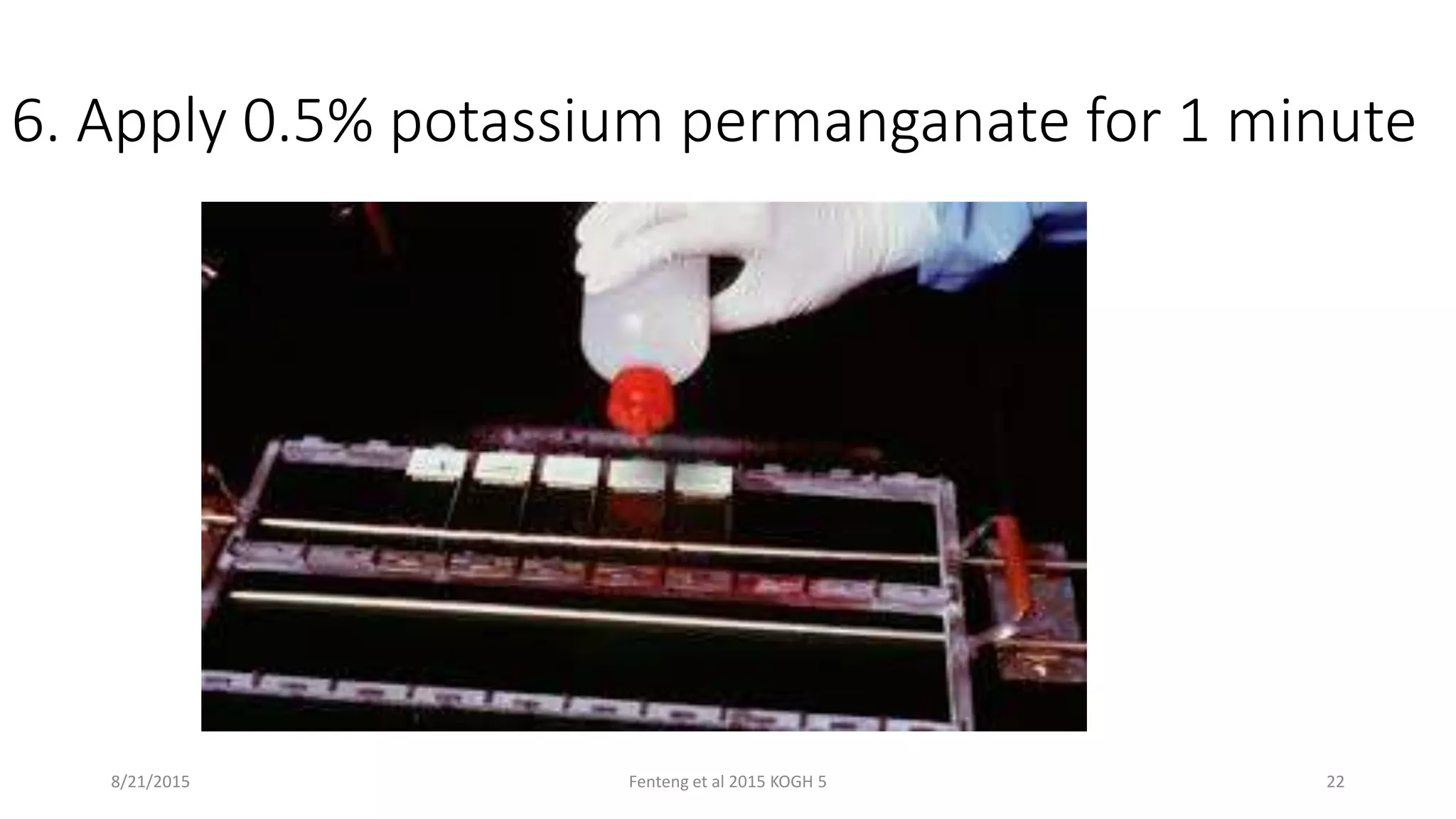 Sputum Examination and Analysis | PPTX