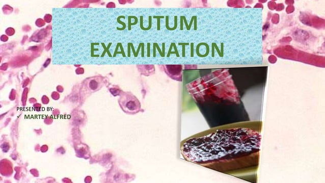 Sputum Examination and Analysis | PPTX | Lung and Respiratory Health | Diseases and Conditions