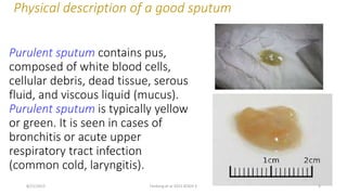 Sputum Examination and Analysis | PPTX