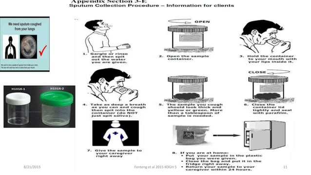 Sputum Examination And Analysis