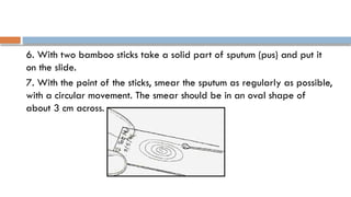 Collection and preservation of Sputum.pptx