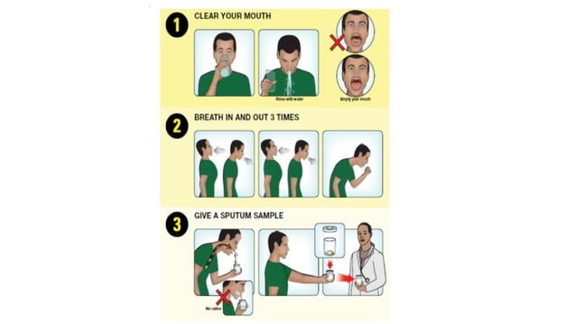 Collection and preservation of Sputum.pptx
