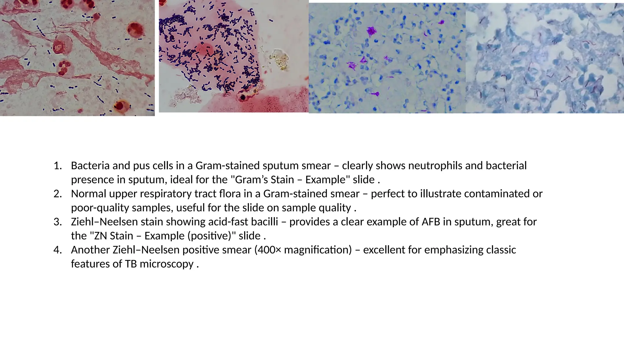 sputum analysis. types of tests to diagnose sputum nature | PPTX