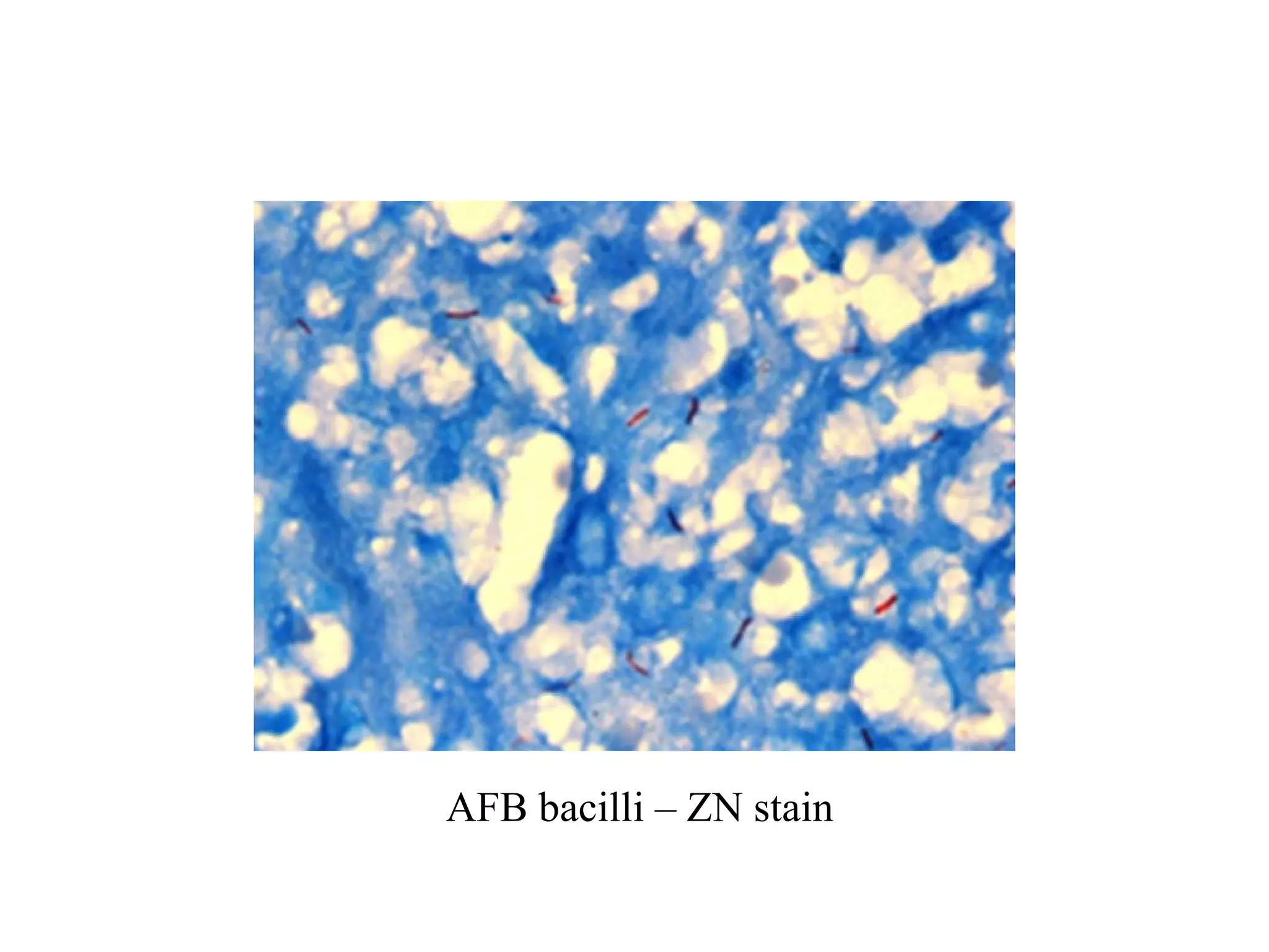 Sputum and body fluids, csf for bpmt | PPT