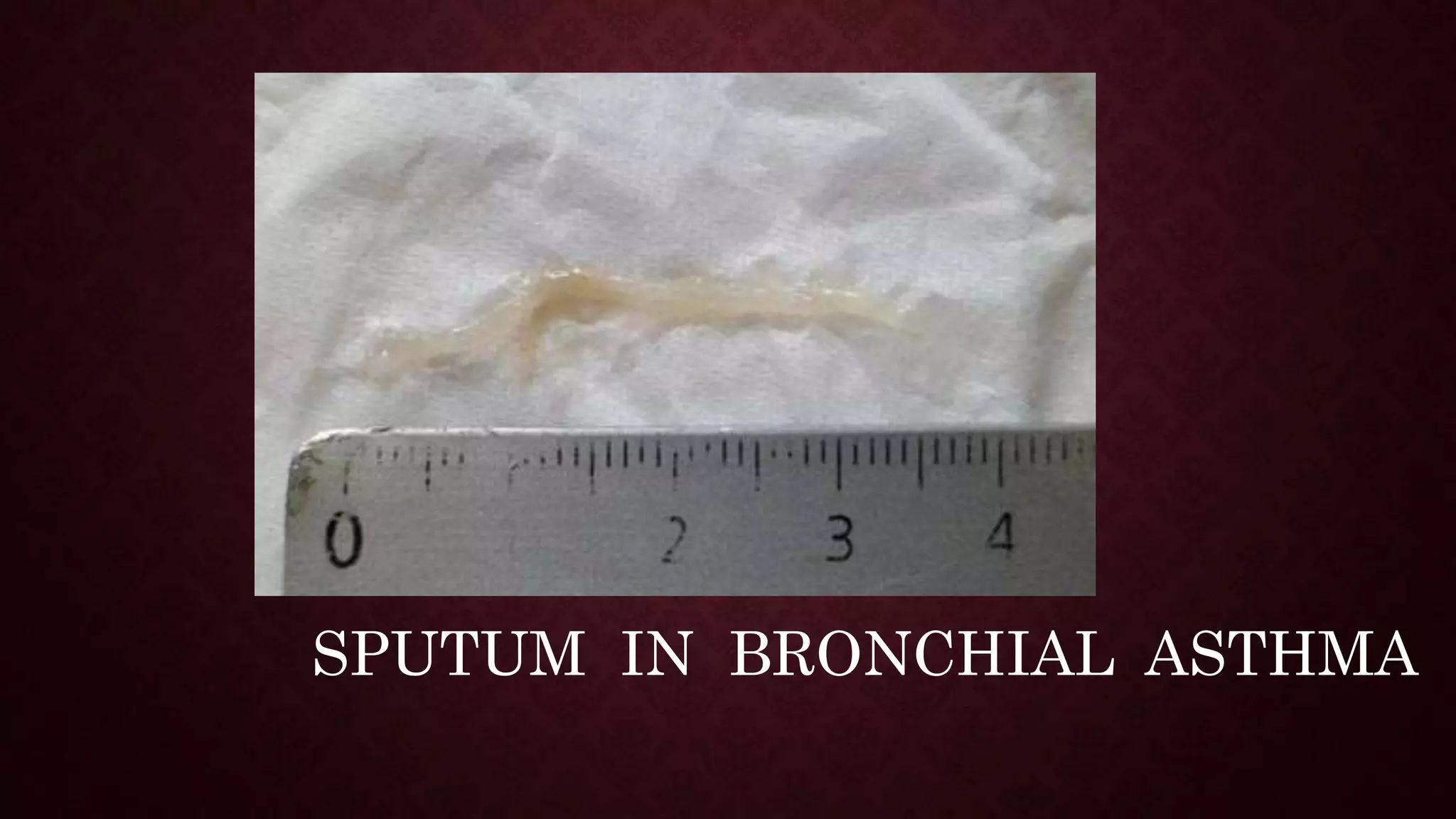 Sputum, chest x rays & spirometry | PPTX | Lung and Respiratory Health ...