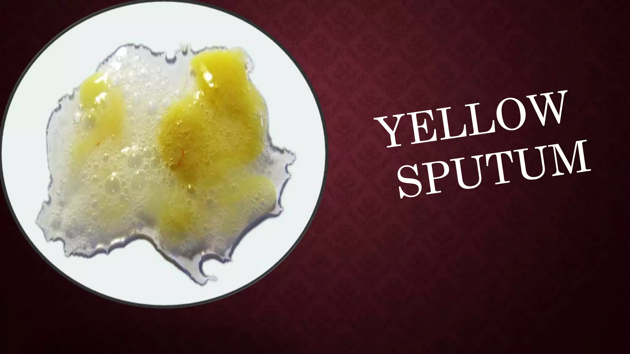 Sputum, chest x rays & spirometry | PPTX | Lung and Respiratory Health ...