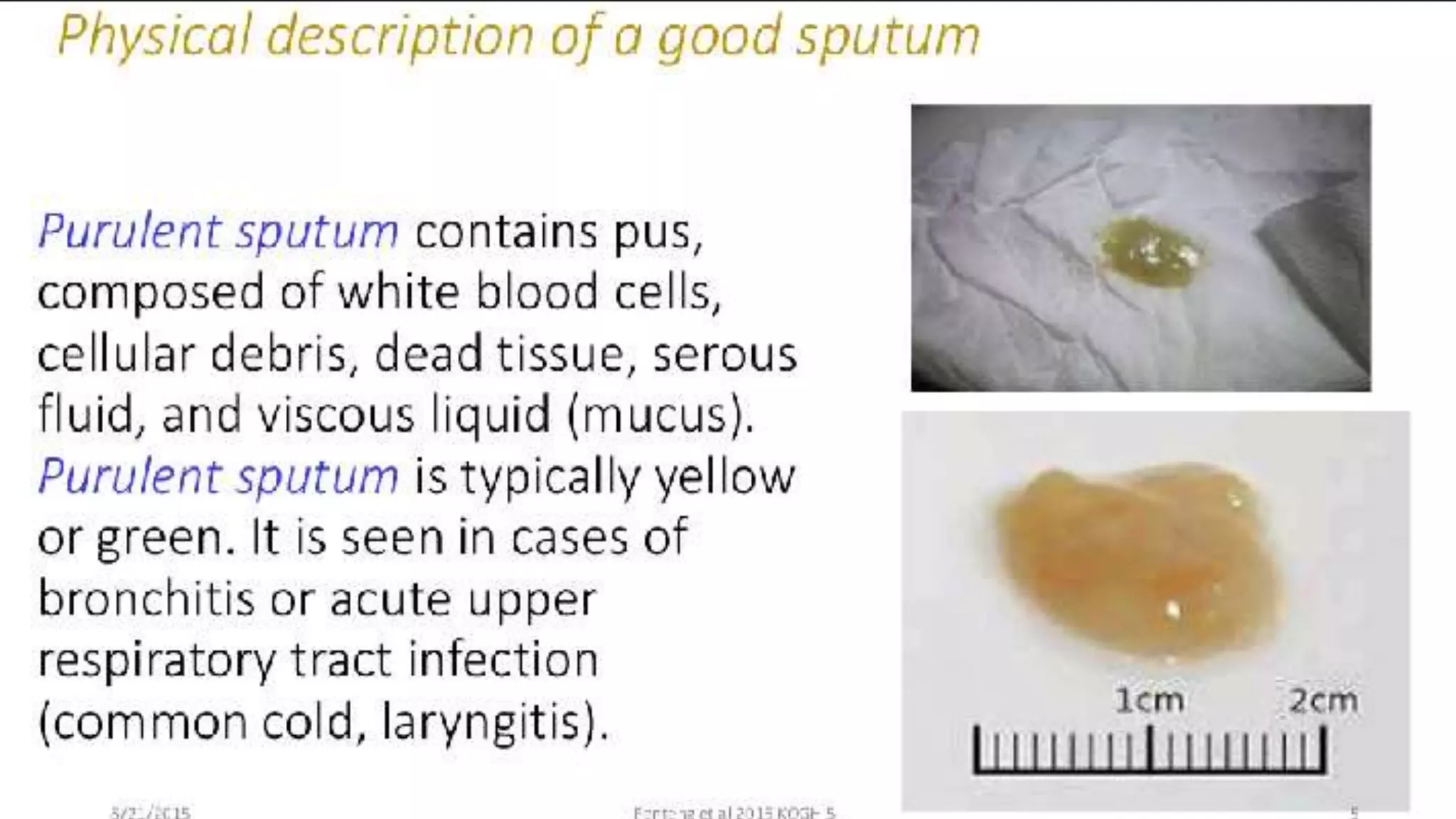 Sputum, chest x rays & spirometry | PPTX | Lung and Respiratory Health ...