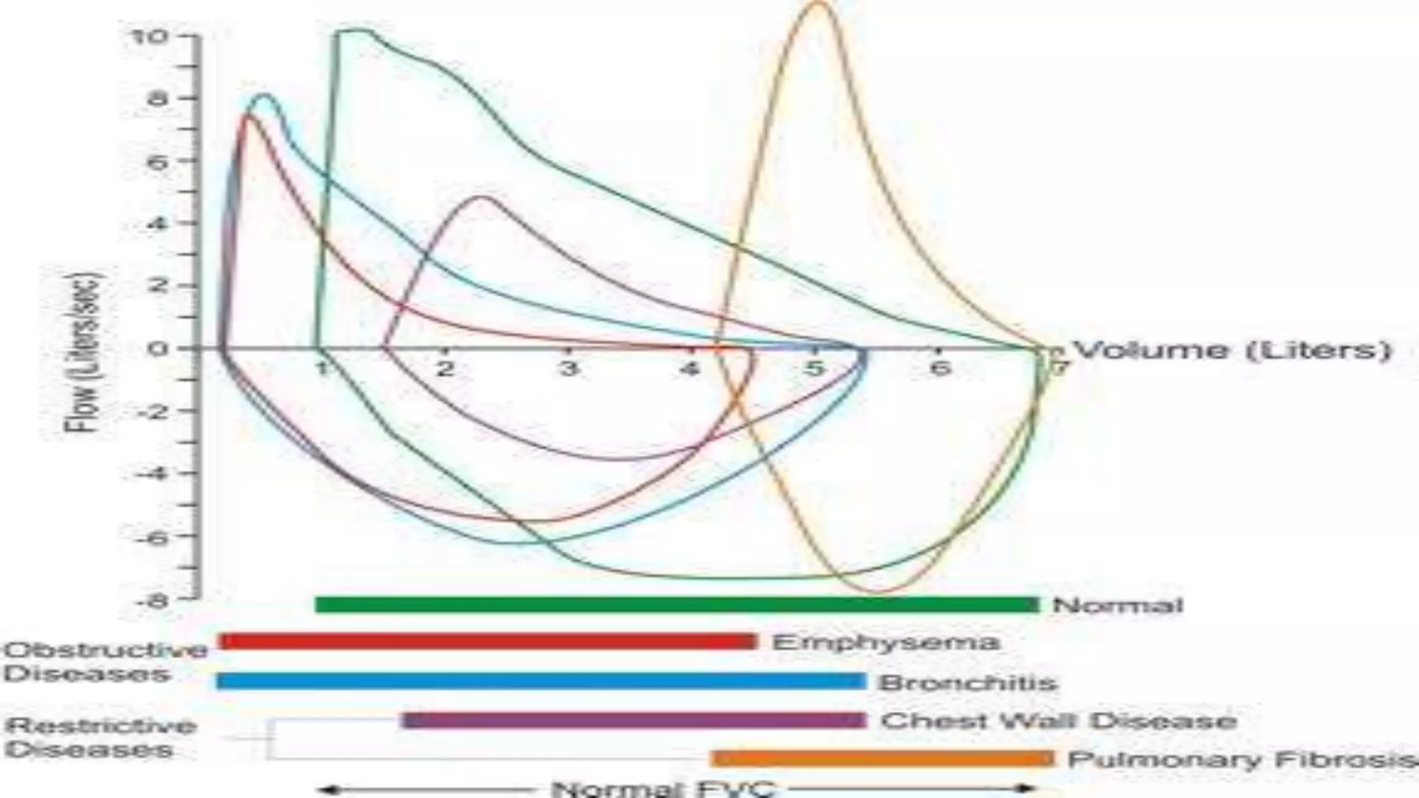Sputum, chest x rays & spirometry | PPTX