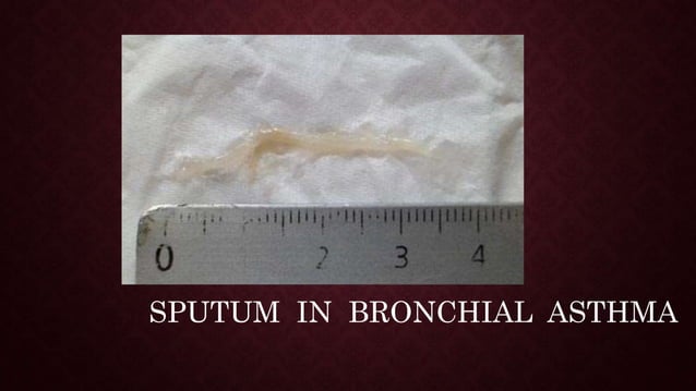 Sputum, chest x rays & spirometry | PPTX | Lung and Respiratory Health ...