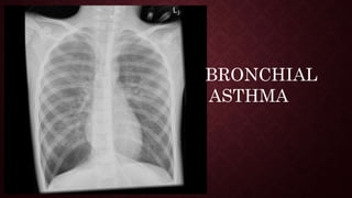 Sputum, chest x rays & spirometry | PPTX
