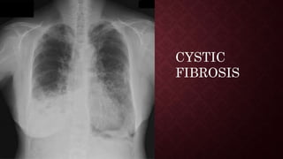 Sputum, chest x rays & spirometry | PPTX