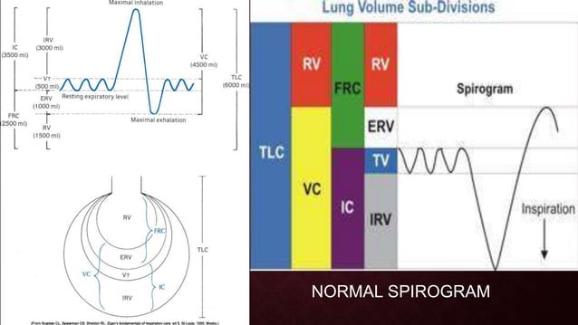 Sputum, chest x rays & spirometry | PPTX | Lung and Respiratory Health ...