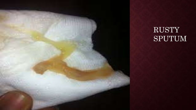 Sputum, chest x rays & spirometry | PPTX | Lung and Respiratory Health ...