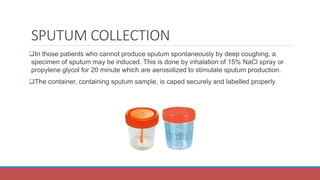 SPUTUM EXAMINATION.pptx