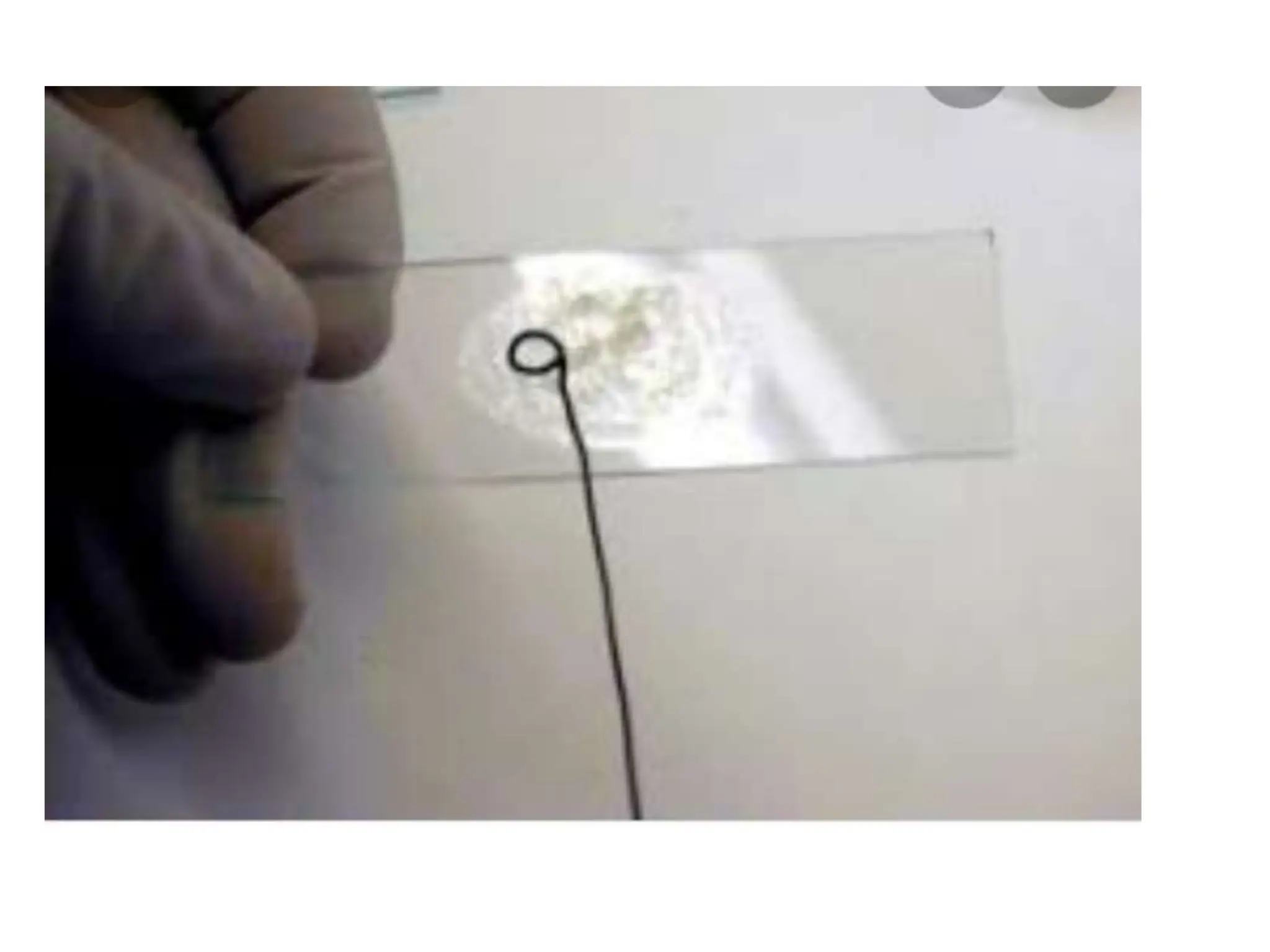 sputum examination pathology 1st year Allied health Sciences RGUHS.pptx