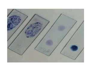 sputum examination pathology 1st year Allied health Sciences RGUHS.pptx