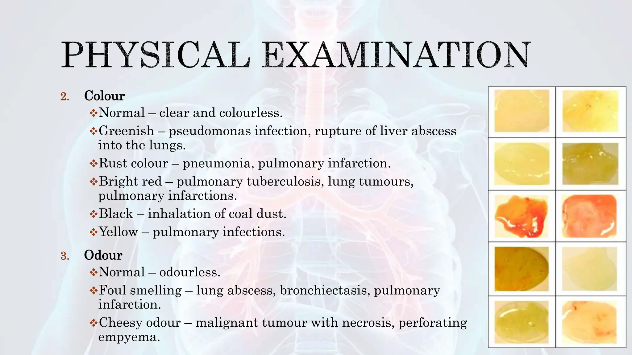 SPHYSICAL, AND MICROSCOPIC EXAMINATION OF SPUTUM | PPTX