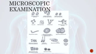 SPHYSICAL, AND MICROSCOPIC EXAMINATION OF SPUTUM | PPTX