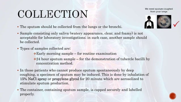 SPHYSICAL, AND MICROSCOPIC EXAMINATION OF SPUTUM | PPTX | Lung and ...