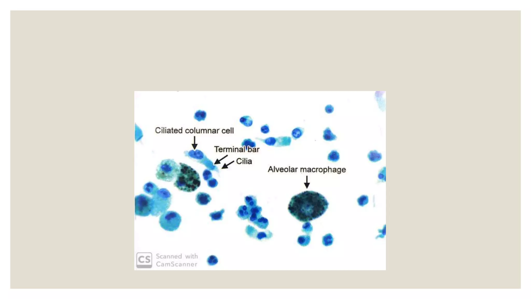 Sputum examination cytology and microscopy | PPTX