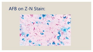 Sputum examination cytology and microscopy | PPTX