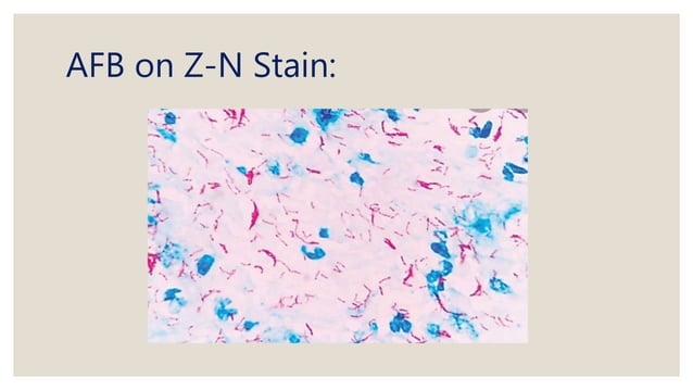 Sputum examination cytology and microscopy | PPTX