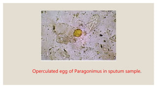 Sputum examination cytology and microscopy | PPTX