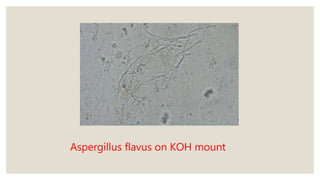 Sputum examination cytology and microscopy | PPTX