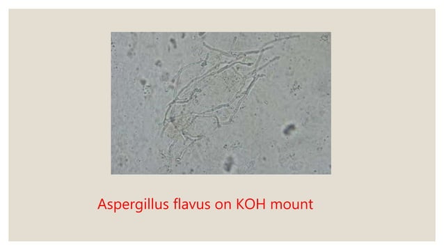 Sputum examination cytology and microscopy | PPTX