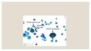 Sputum examination cytology and microscopy | PPTX