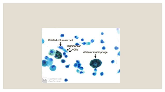 Sputum examination cytology and microscopy | PPTX