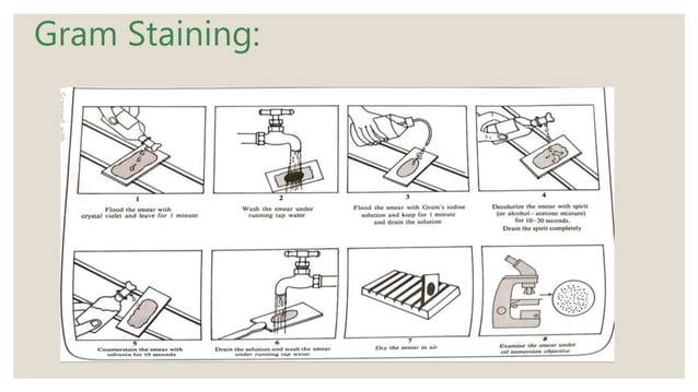 Sputum examination cytology and microscopy | PPTX