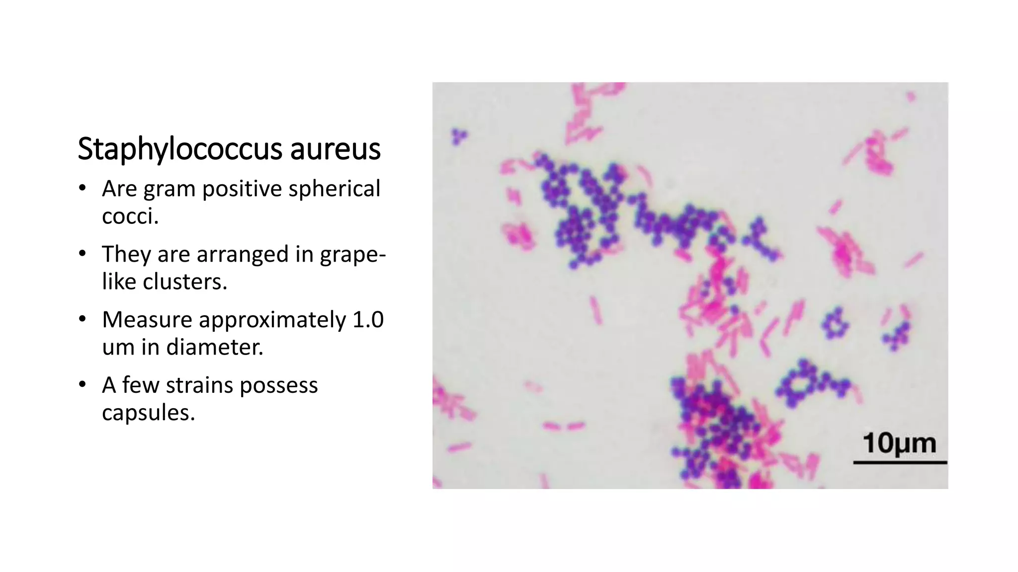 SPUTUM GRAM STAIN.pptx