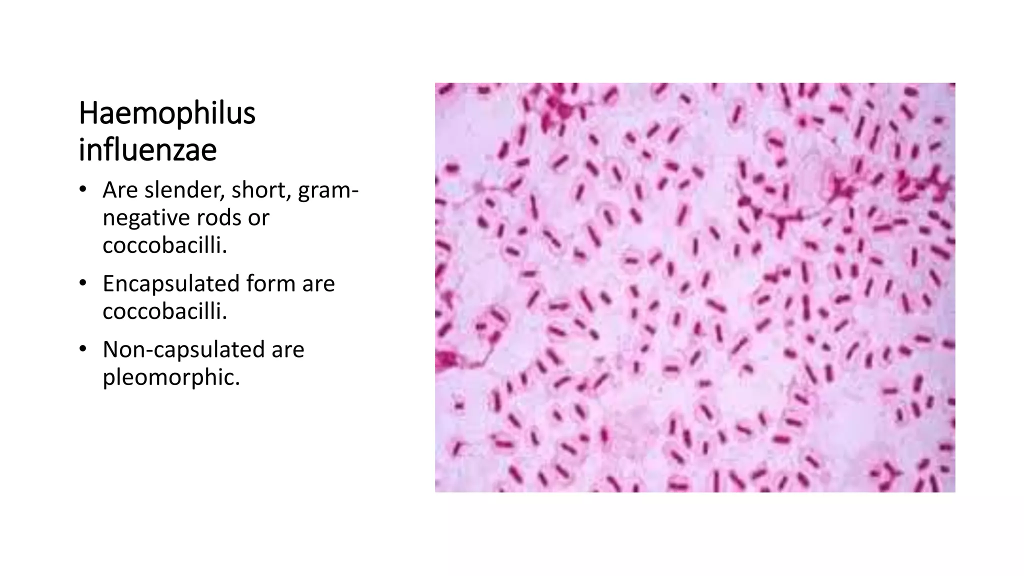 SPUTUM GRAM STAIN.pptx