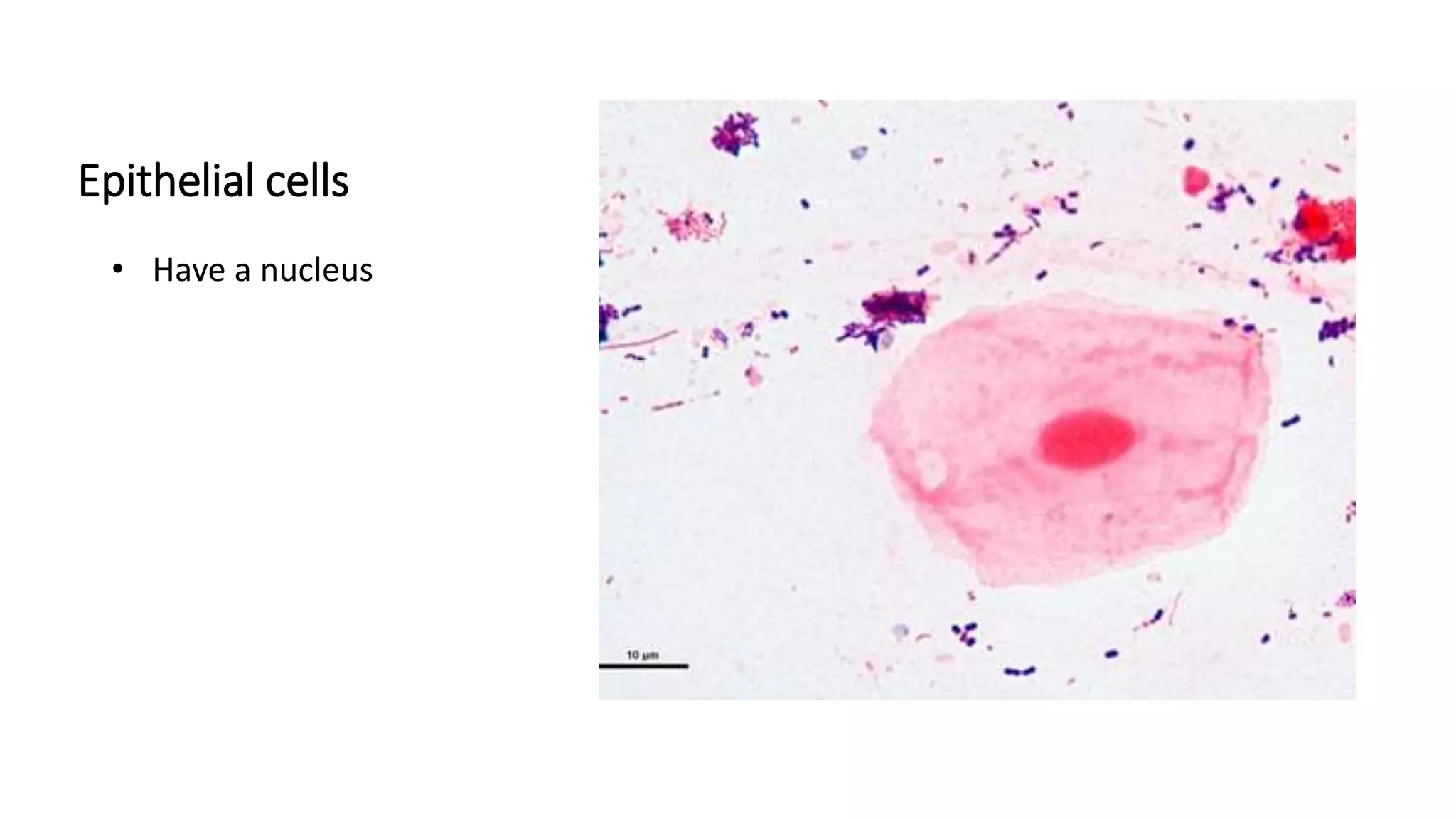 SPUTUM GRAM STAIN.pptx