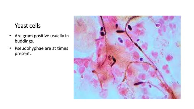 SPUTUM GRAM STAIN.pptx