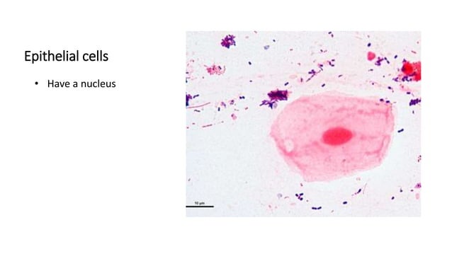 SPUTUM GRAM STAIN.pptx