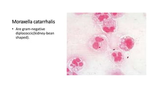 Moraxella Catarrhalis Gram Stain 100x