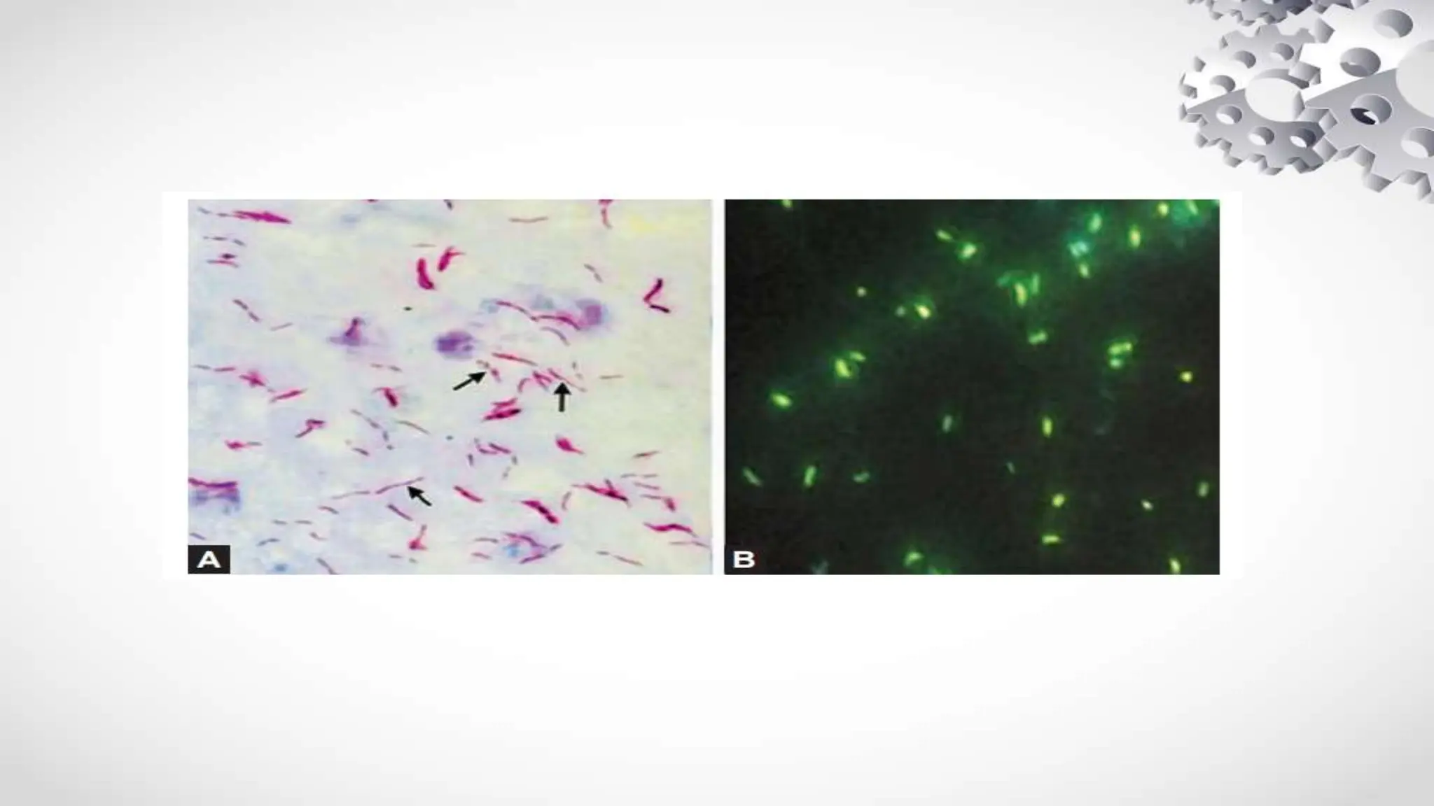 SPUTUM culture IN Tuberculosis acid fast bacilli.pptx