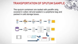 SPUTUM culture IN Tuberculosis acid fast bacilli.pptx
