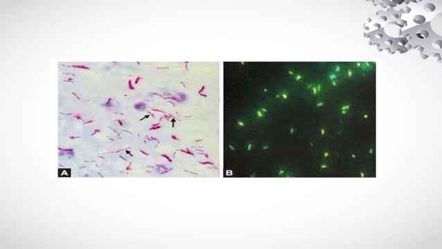 SPUTUM culture IN Tuberculosis acid fast bacilli.pptx