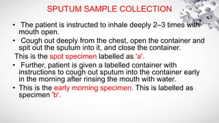 SPUTUM culture IN Tuberculosis acid fast bacilli.pptx