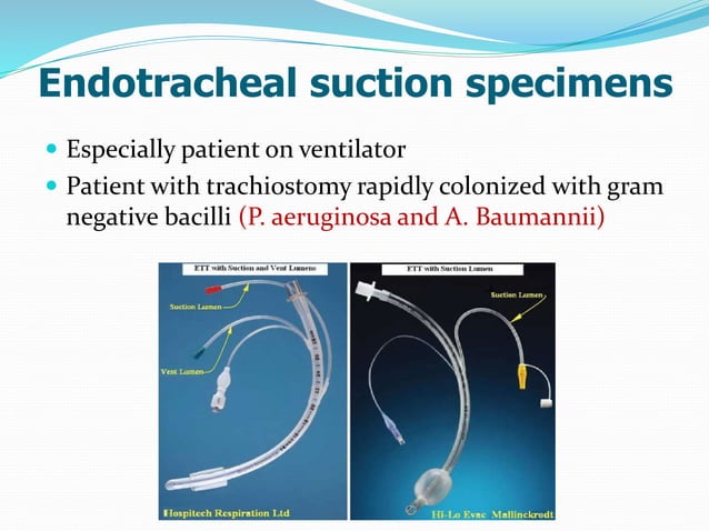 Sputum sample processing.pptx