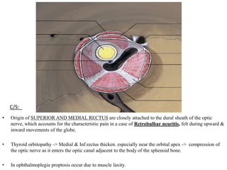 Extra ocu.movement by pushkar dhir | PPT