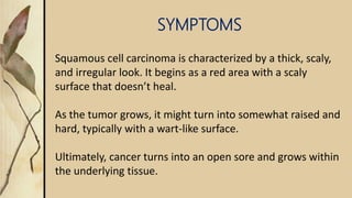 Squamous cell carcinoma of skin | management -all medical aspects. | PPTX